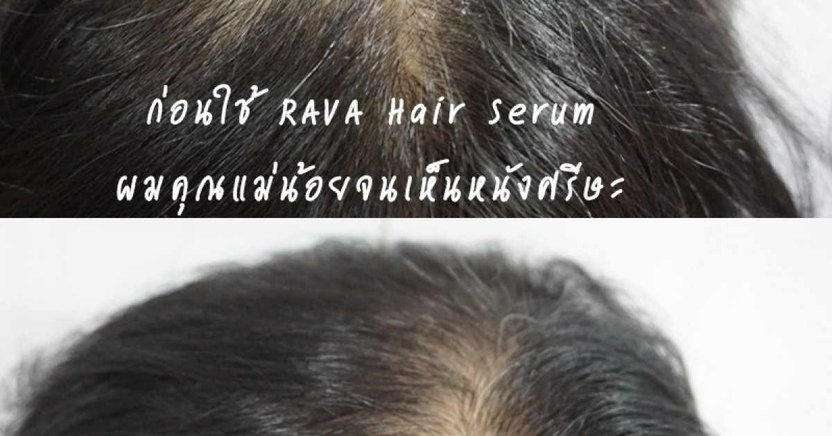 คุณแม่ปลื้ม คุณลูกhappy ผมร่วงน้อยลง หนังศรีษะสุขภาพดี ใช้ตัวนี้ Rava ...