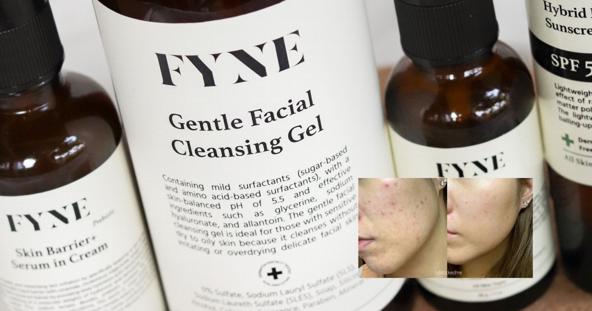 Review Fyne skincare เกือบทั้งไลน์กับผลลัพธ์การรักษาสิวที่ดีมากก