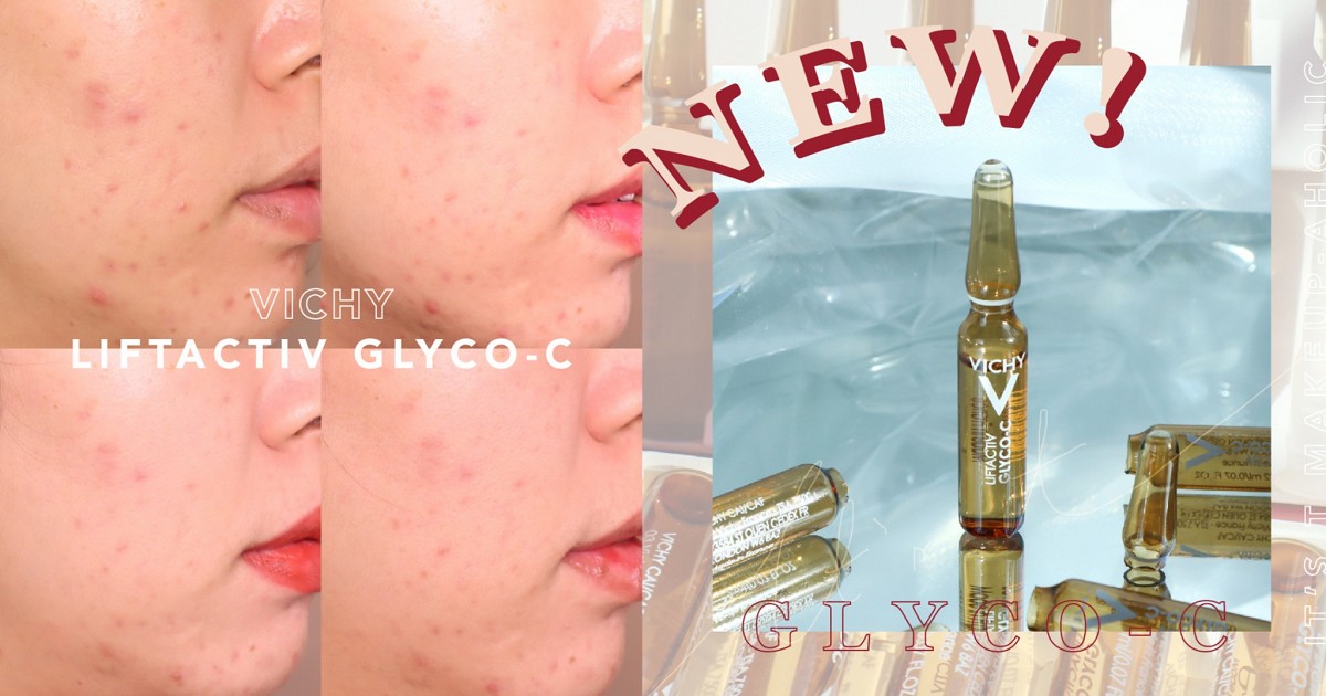 14 Nights Peel! Glyco-C ช่วยลดรอยสิว จุดด่างดำ แอมพูลตัวใหม่ที่ควรลอง!
