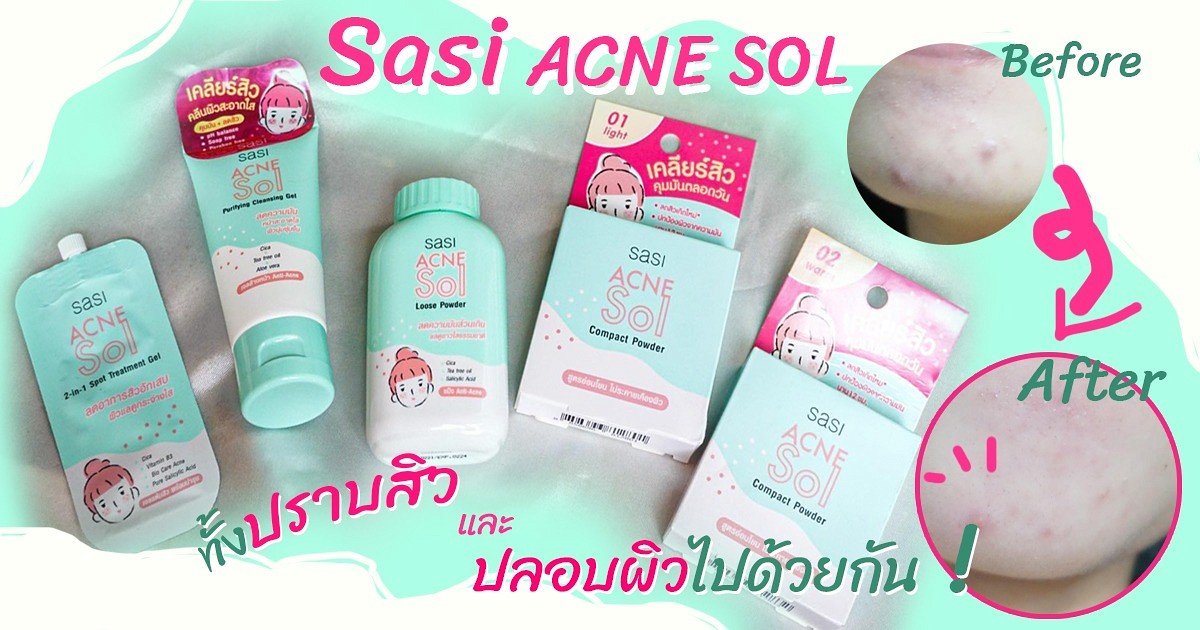 สิวขึ้นไม่ใช่ปัญหา! Sasi ACNE Sol ปราบสิว ปลอบผิวไปพร้อมๆกัน