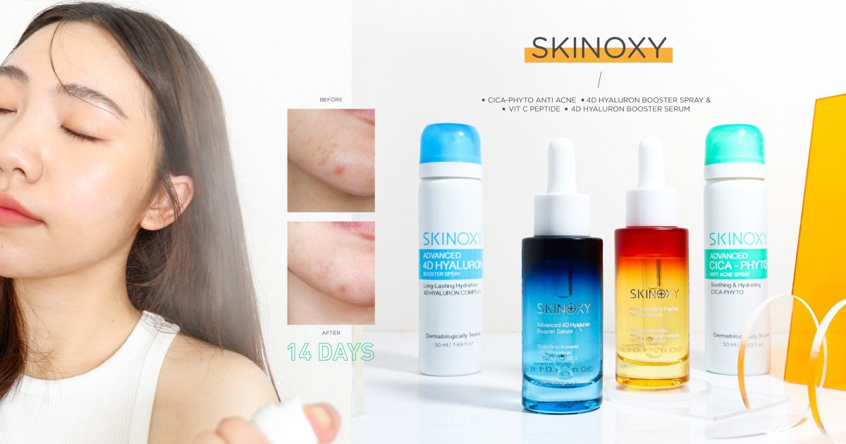 เคลียปัญหาผิวทั้งสิวทั้งรอย ด้วย SKINOXY 14 วัน ผิวปังขึ้นมั้ย