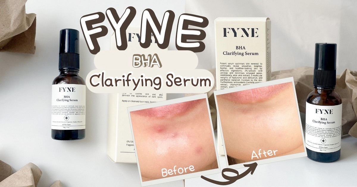 สิว !! ปัญหาของผิว จัดการได้ด้วย FYNE BHA Clarifying Serum