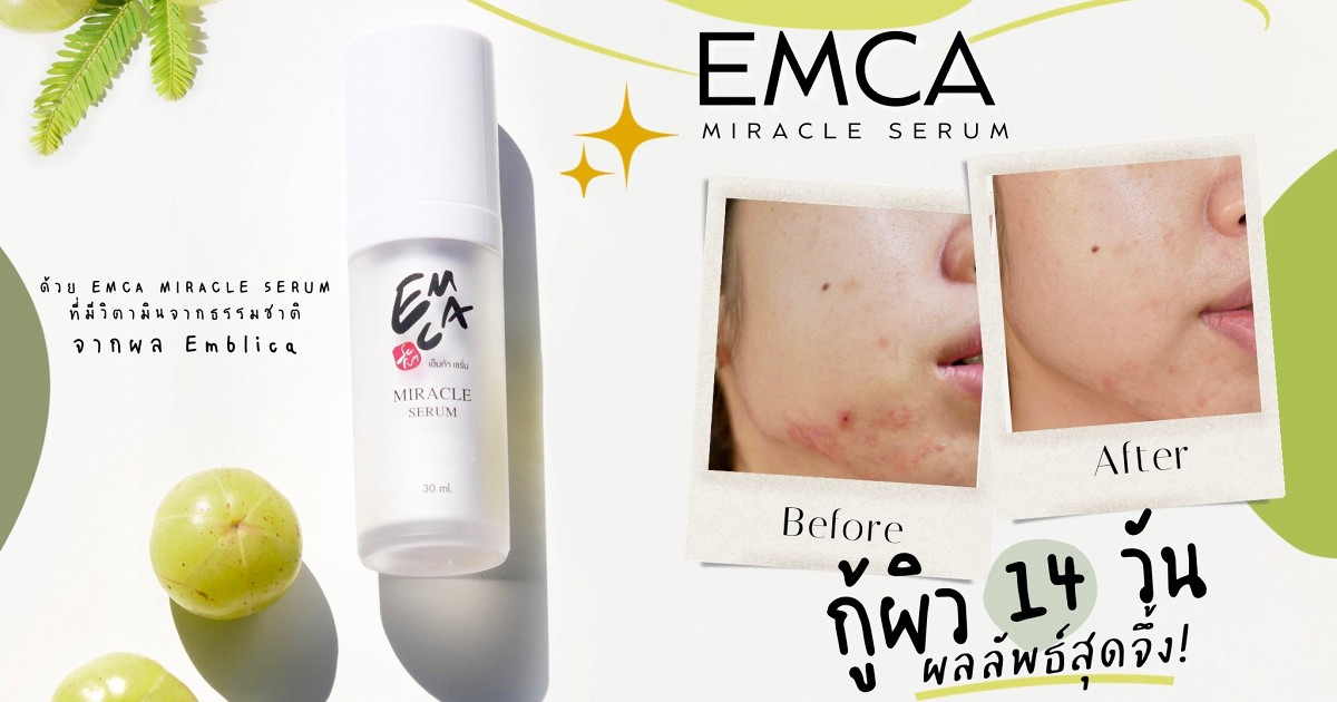 ผลลัพธ์สุดจึ้ง! กู้ผิว 14 วัน กับ EMCA Miracle Serum ด้วย Emblica