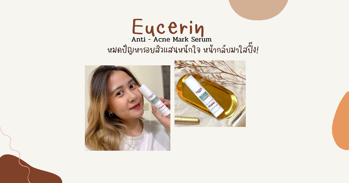 กราบ Eucerin Anti Acne mask serum หมดปัญหารอยสิวแสนหนักใจ หน้ากลับมาใสปิ๊ง!