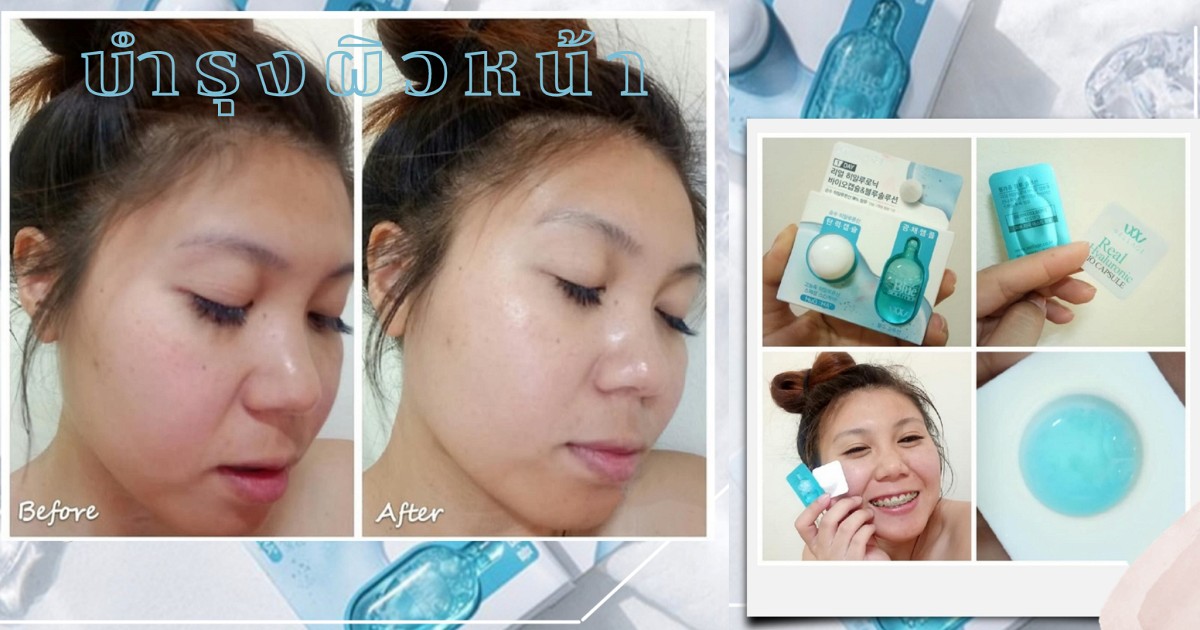 ฟื้นฟูผิวหน้าาด้วย Wellage Real Hyaluronic Bio Capsule 1's ไฮยาลูรอนเกาหลี