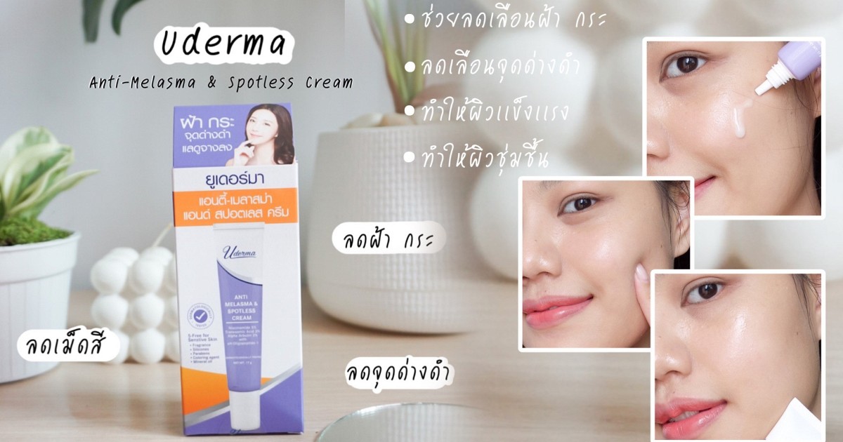 บอกต่อ เคล็บลับเเก้ฝ้าหน้าใส ด้วยครีมทาฝ้า Uderma
