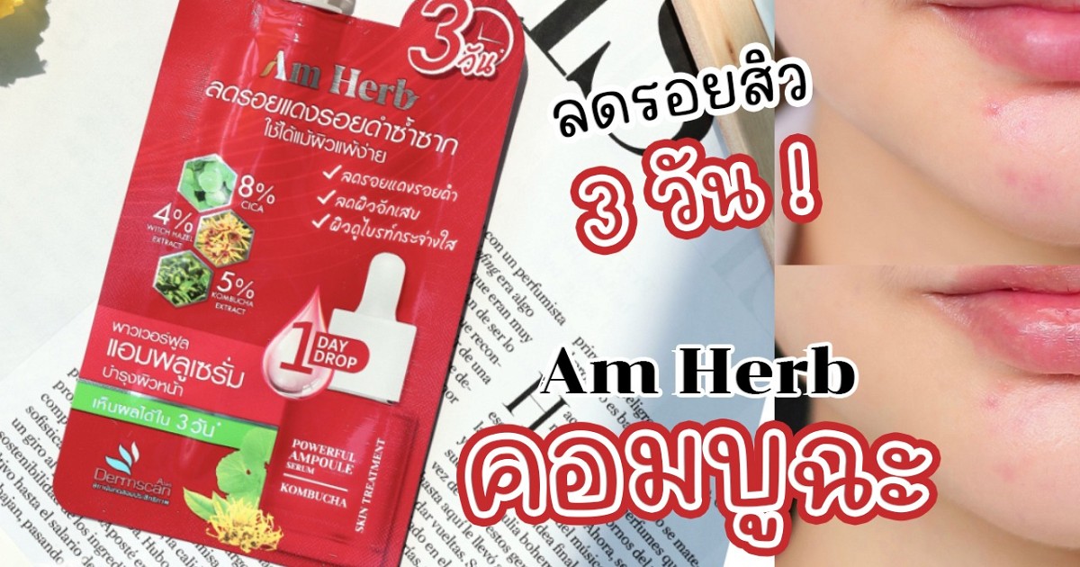 รอยสิวจางลงได้ใน 3 วันด้วย Am Herb คอมบูฉะ จริงไม่จริงมาลองกัน
