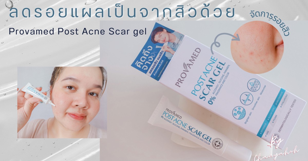 ลดรอยแผลเป็นจากสิว ด้วย Provamed Post Acne Scar gel