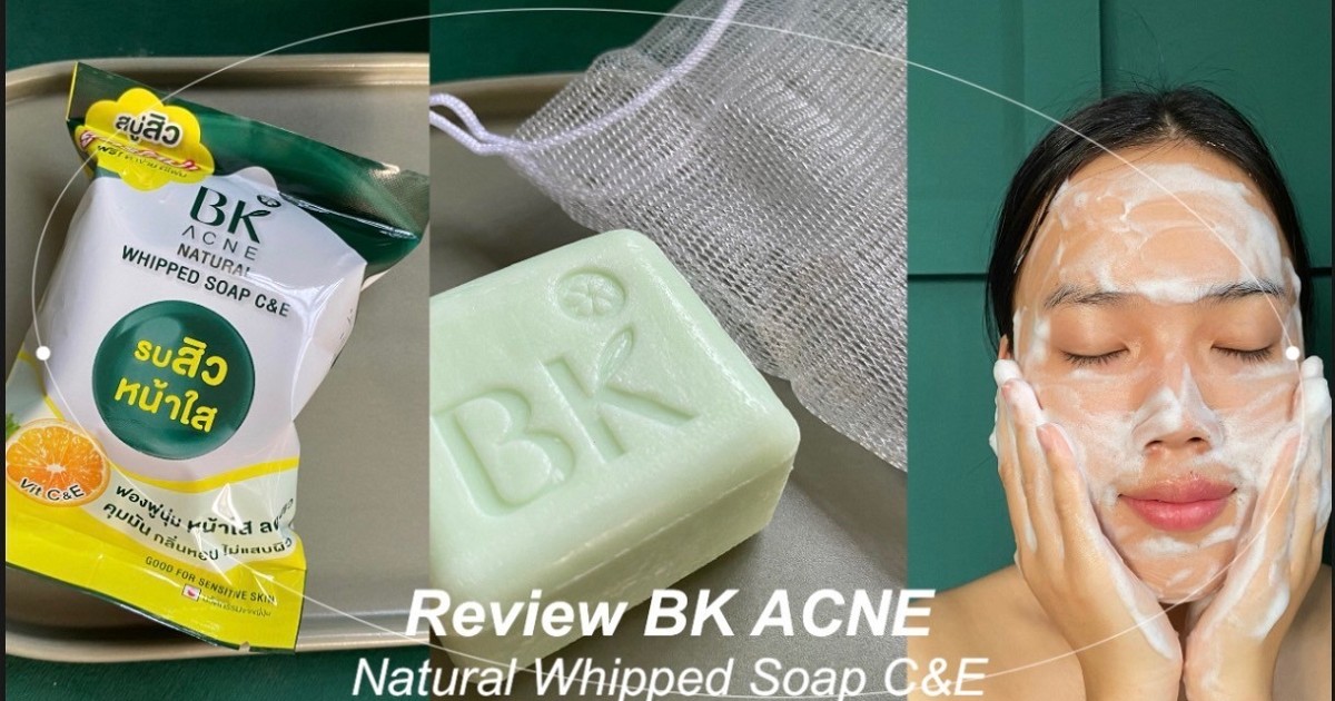 รีวิวสบู่ BK ACNE รบสิว