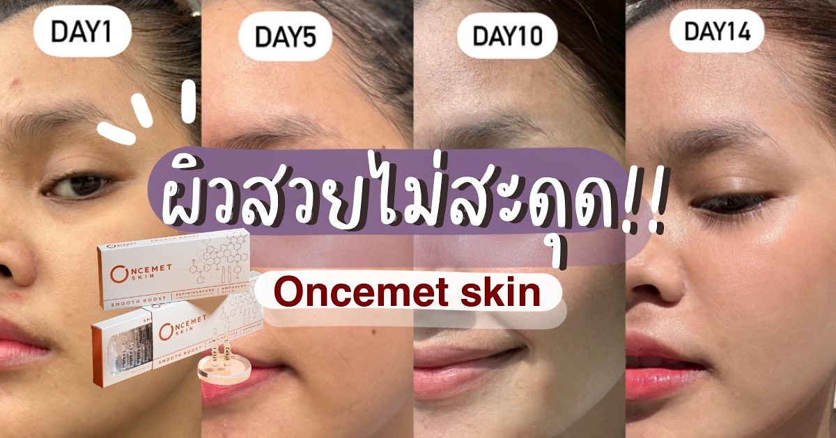ผิวสวยไม่สะดุด กับ Oncemet Skin