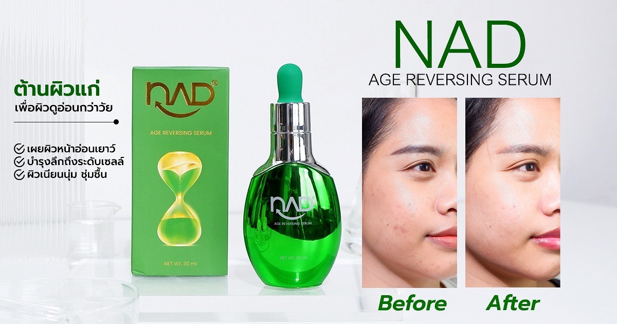 ผิวโทรมจากวัยและความเครียด ฟื้นได้จริงเหรอ? ลอง NAD Age Reversing Serum ...