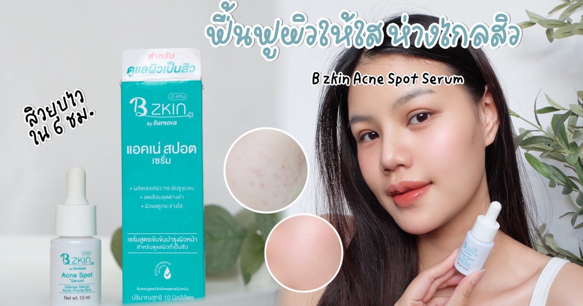เซรั่มเข้มข้น สิวยุบไวใน 6 ชม. เพื่อหน้าใส ด้วย B zkin Acne Spot Serum