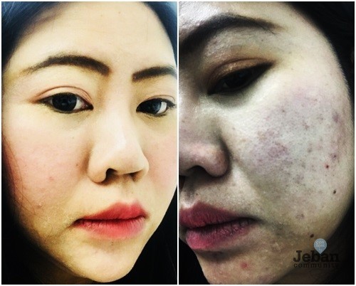 ไอเท็มเด็ด ครีมเติมน้ำให้ผิว AQUASOURCE AURAGEL ภายใต้แบรนด์ BIOTHERM