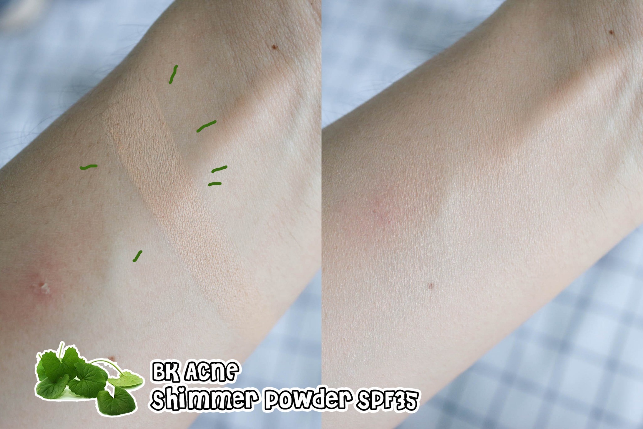 #Review รีวิว | BK ACNE | แป้งฝุ่น และ แป้งผสมรองพื้น สำหรับคนเป็นสิว ...