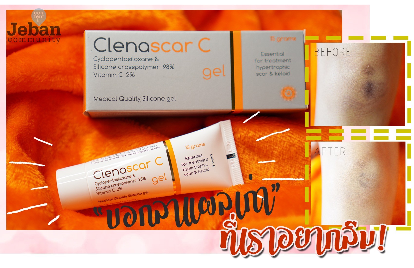 บอกลา "แผลเก่า" ที่เราอยากลืมด้วยClenascar C gel