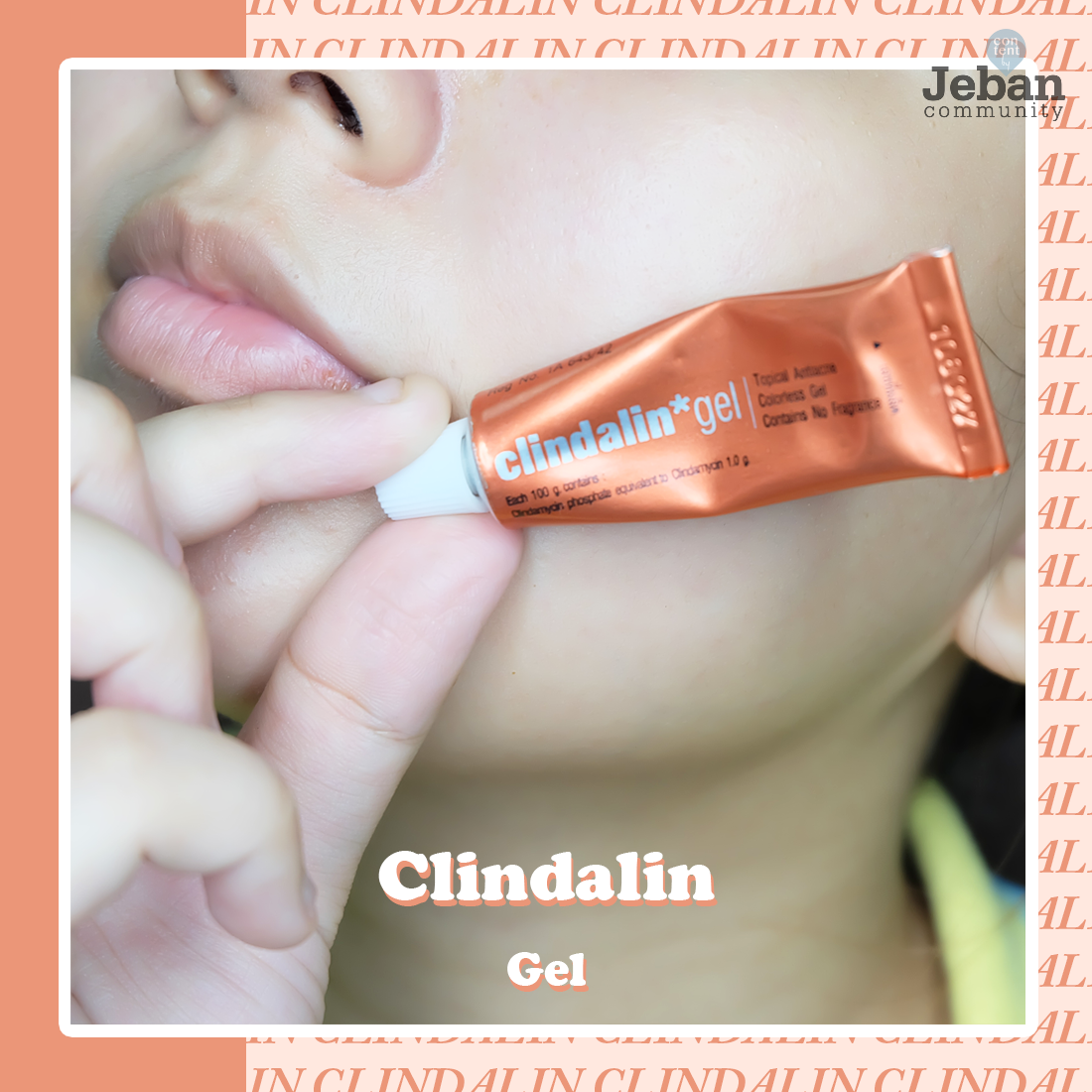 [Review] รีวิว วิธีรักษาสิวให้หายขาด ด้วยตนเอง โดยใช้ไอเทมถูกและดี ...