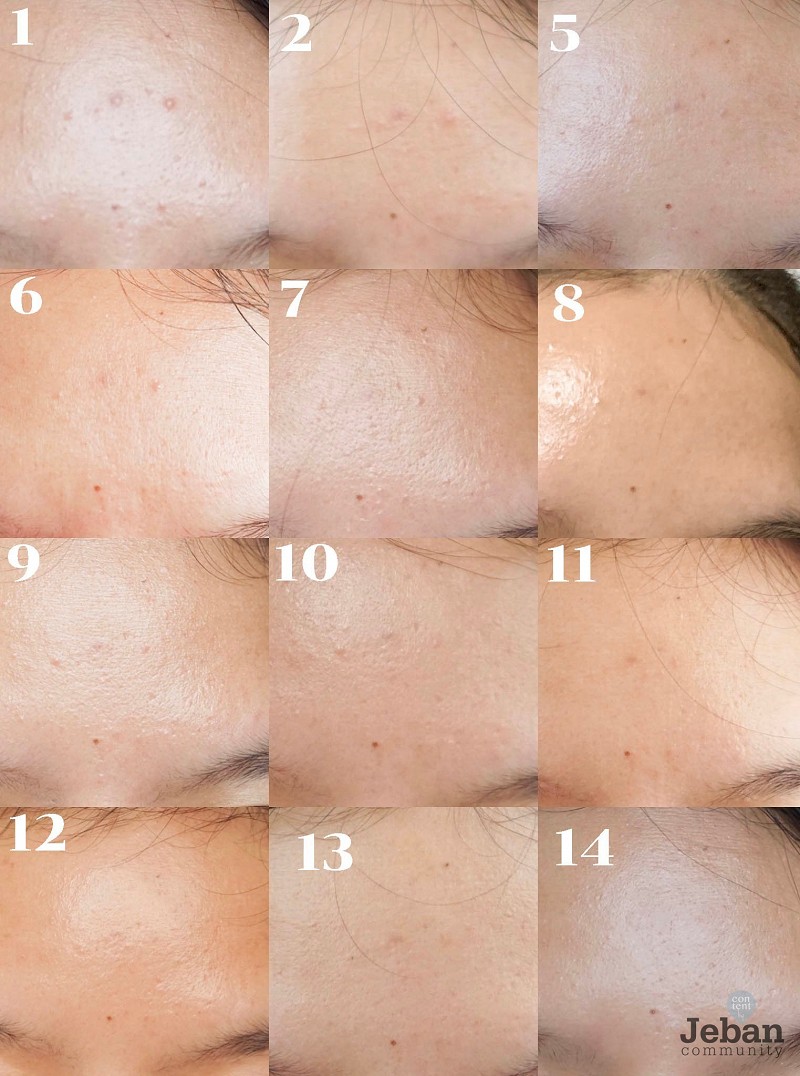 รีวิวเซรั่มลดสิวผิวใส! Glow Mori Vitamin Ball Acne Serum ใครๆ ก็ว่านาง ...