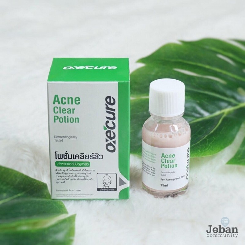 OXE’CURE ACNE CLEAR POTION แป้งน้ำหยุดสิว สูตรลับไร้สิวใน 1 คืน!!