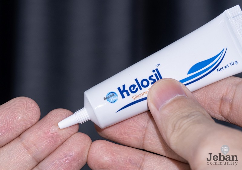 เคลียร์จบทุกรอยแผลเป็นง่ายๆ ราวกับไม่มีเคยมีมาก่อนด้วย Kelosil Silicone ...