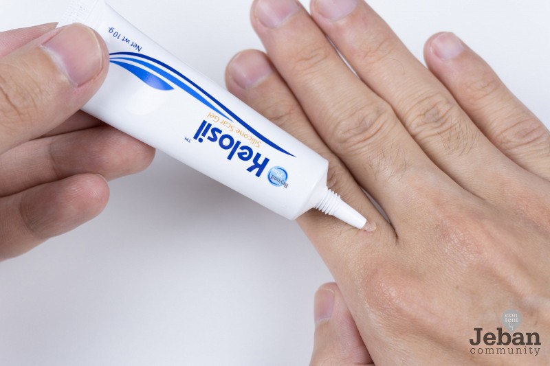 เคลียร์จบทุกรอยแผลเป็นง่ายๆ ราวกับไม่มีเคยมีมาก่อนด้วย Kelosil Silicone ...