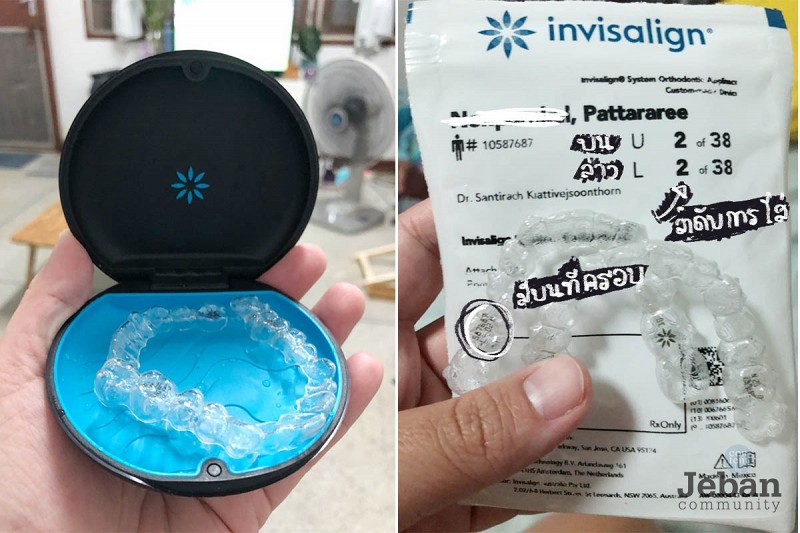 รีวิวจัดฟันใสแบบ Invisalgin ดีจริงไหม