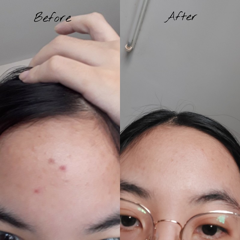 FYNE BHA Clarifying Serum