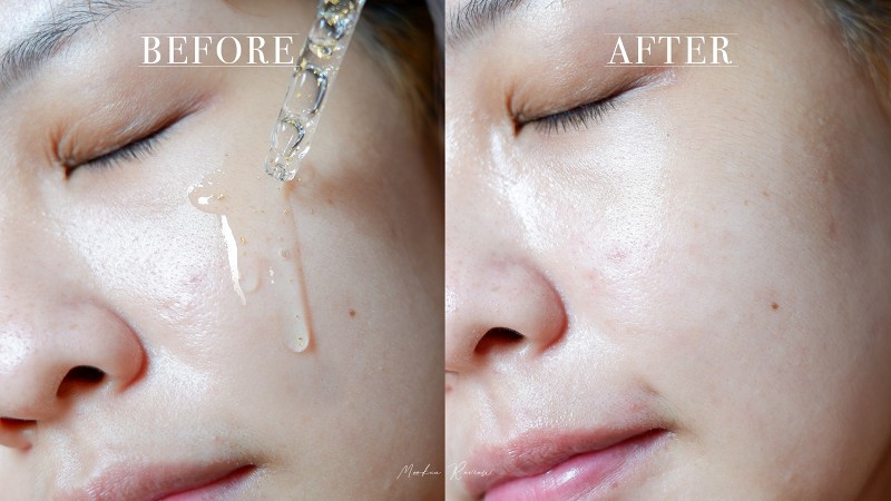 [Review] : Smooth E Gold 24K & Uplift Derma Roller ตัวช่วยยกกระชับผิวเด็ก