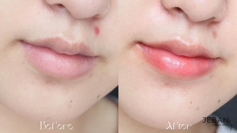 อ่อนโยนต่อผิว ลดสิวอุดตัน FYNE BHA CLARIFING SERUM Cloudysstory