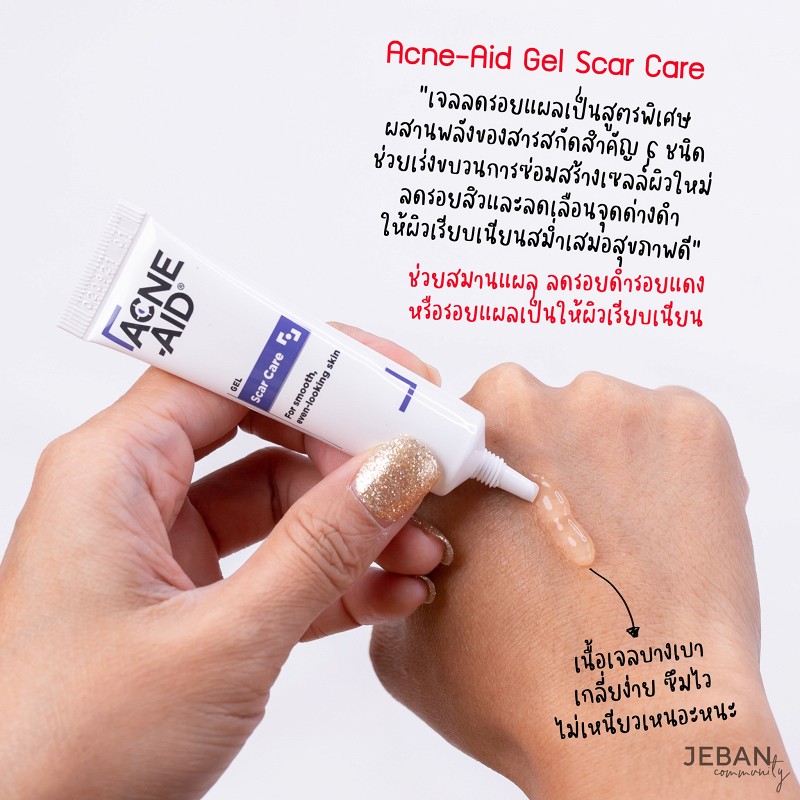 รีวิว Acne-Aid Complete Solutions เซ็ตกู้ผิวสำหรับคนเป็นสิว