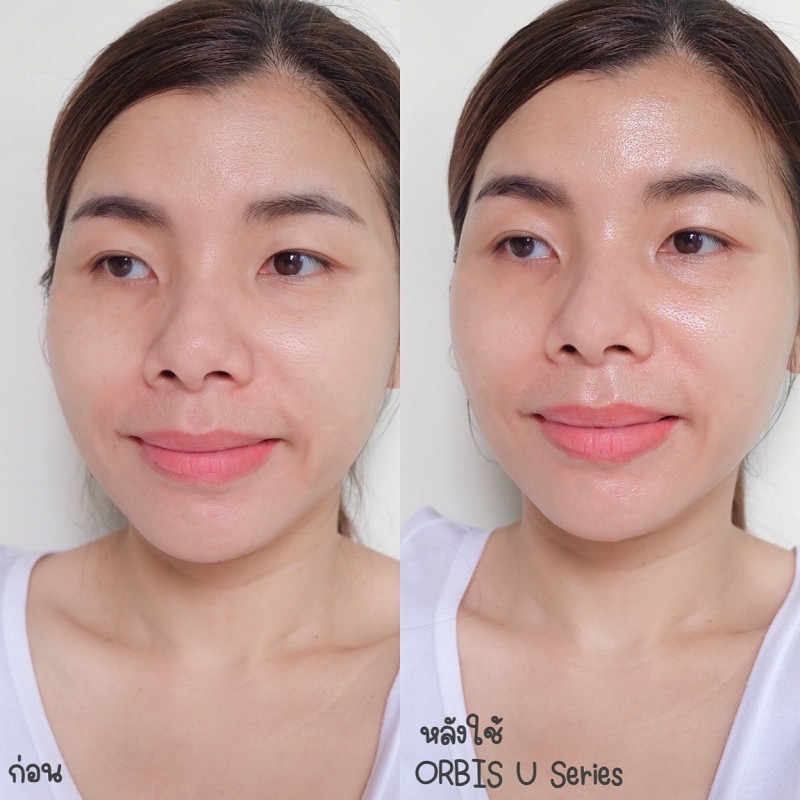 ORBIS U Series : ความชุ่มชื้น คือพื้นฐานสำคัญของผิว