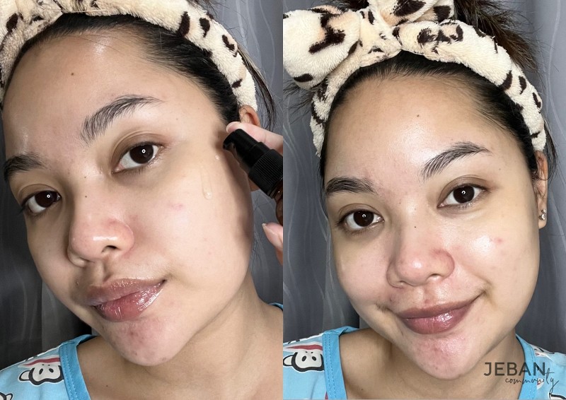 Review* เซรั่ม FYNE BHA Clarifying Serum สุดฮิตในไอจี!!!