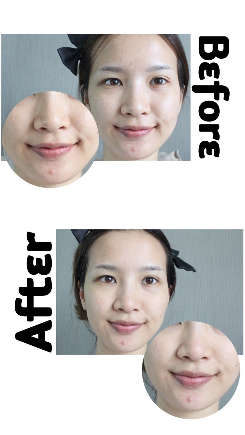 pop up skin มาร์คโคลนดูดสิวสุดจะคิ้วทึ ดีท็อกผิวให้เนียนใส