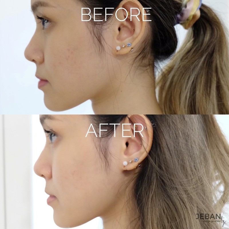 Cavy Mini IPL เดี๋ยวนี้เค้ามีเครื่อง IPL กำจัดขน/ หน้าใส แบบพกพาสำหรับ ...