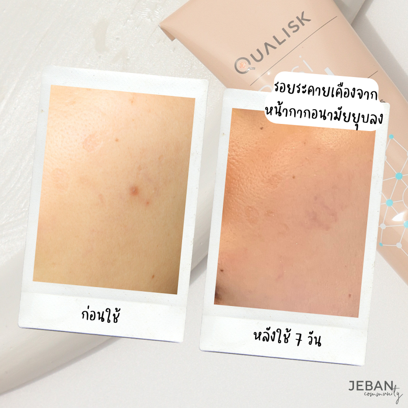เสริมเกราะป้องกันผิว เพื่อสุขภาพผิวที่ดี ด้วย Qualisk Resi Skin
