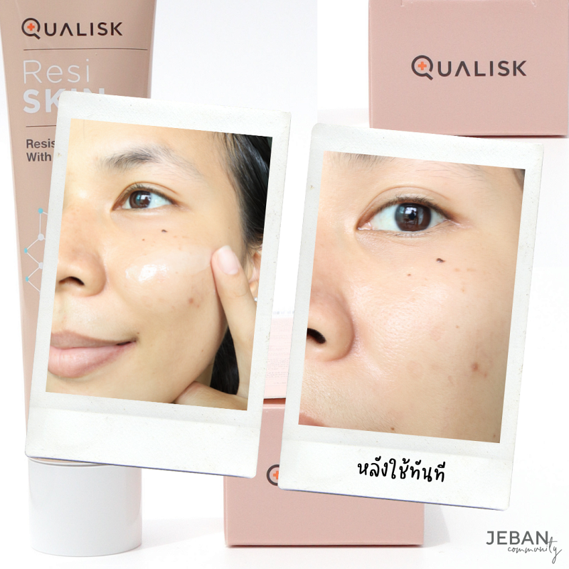 เสริมเกราะป้องกันผิว เพื่อสุขภาพผิวที่ดี ด้วย Qualisk Resi Skin
