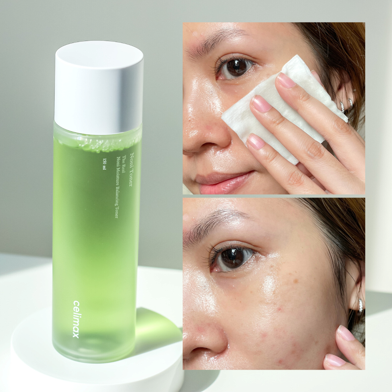 รีวิวสกินแคร์เกาหลี ผิวใส ฉ่ำวาว ดูสุขภาพดี ด้วย Toner และ Ampoule จาก ...