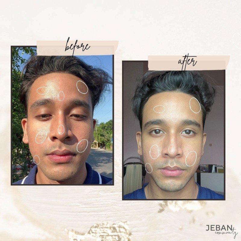 เซรั่มคาลอน Cellular Rejuvenating ขวดนี้ถูกคิดค้นมาเพื่อ Support ทุกสภาพผิว