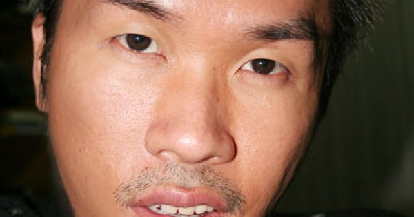 Review - Trifusion วิธีทำหน้าใสไม่ต้องพึ่งเข็ม